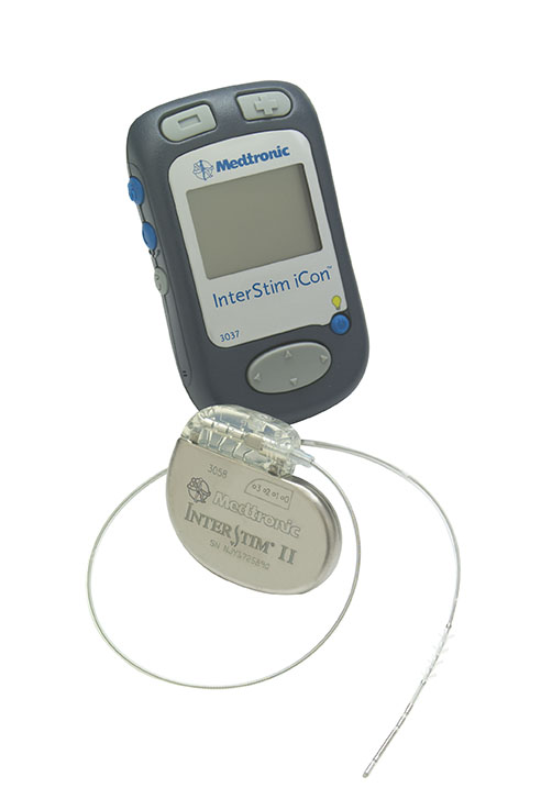 Sacrale neuromodulatie - Urologie Bravis Ziekenhuis